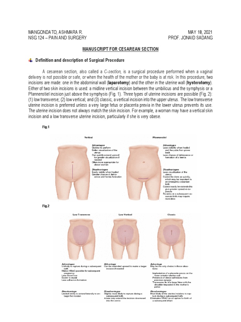 Cesarean Section | PDF | Caesarean Section | Childbirth