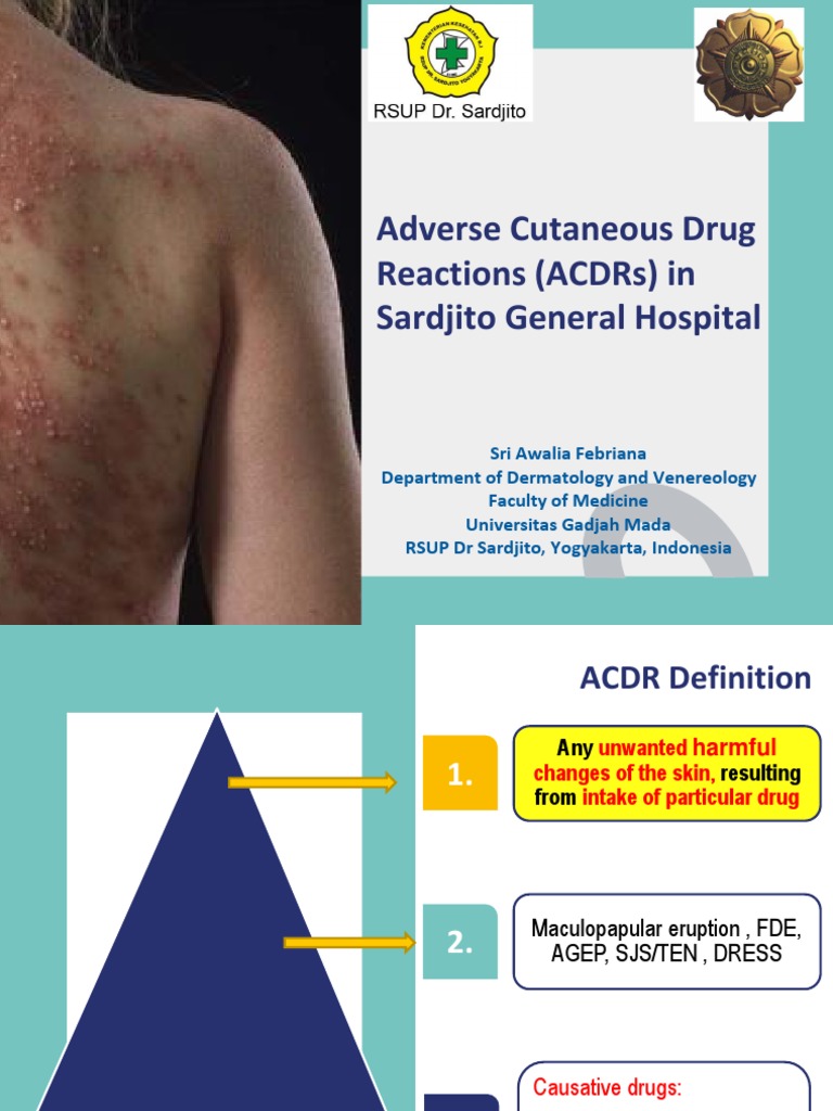 Adverse Cutaneous Drug Reactions (Acdrs) in Sardjito General Hospital ...