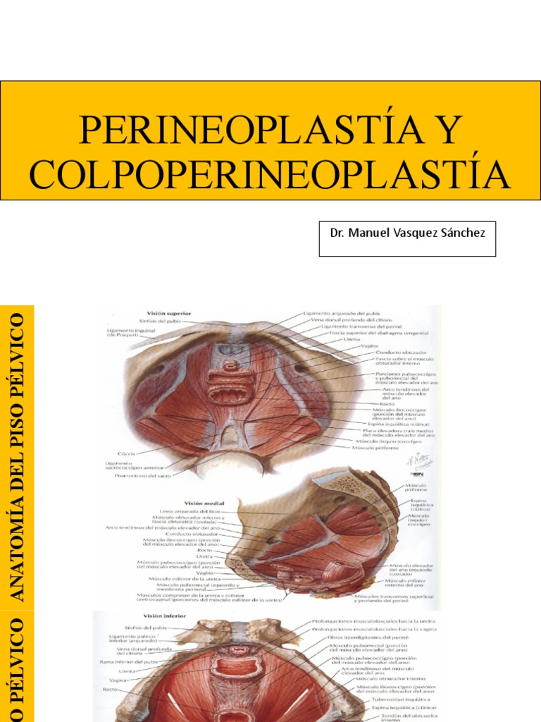 Ok - Perineoplastía y Colpoperineoplastia - Ok 1 | PDF | Vagina | Cirugía