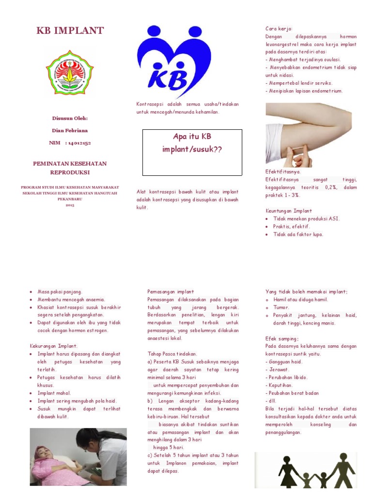 Panduan KB Implan | PDF