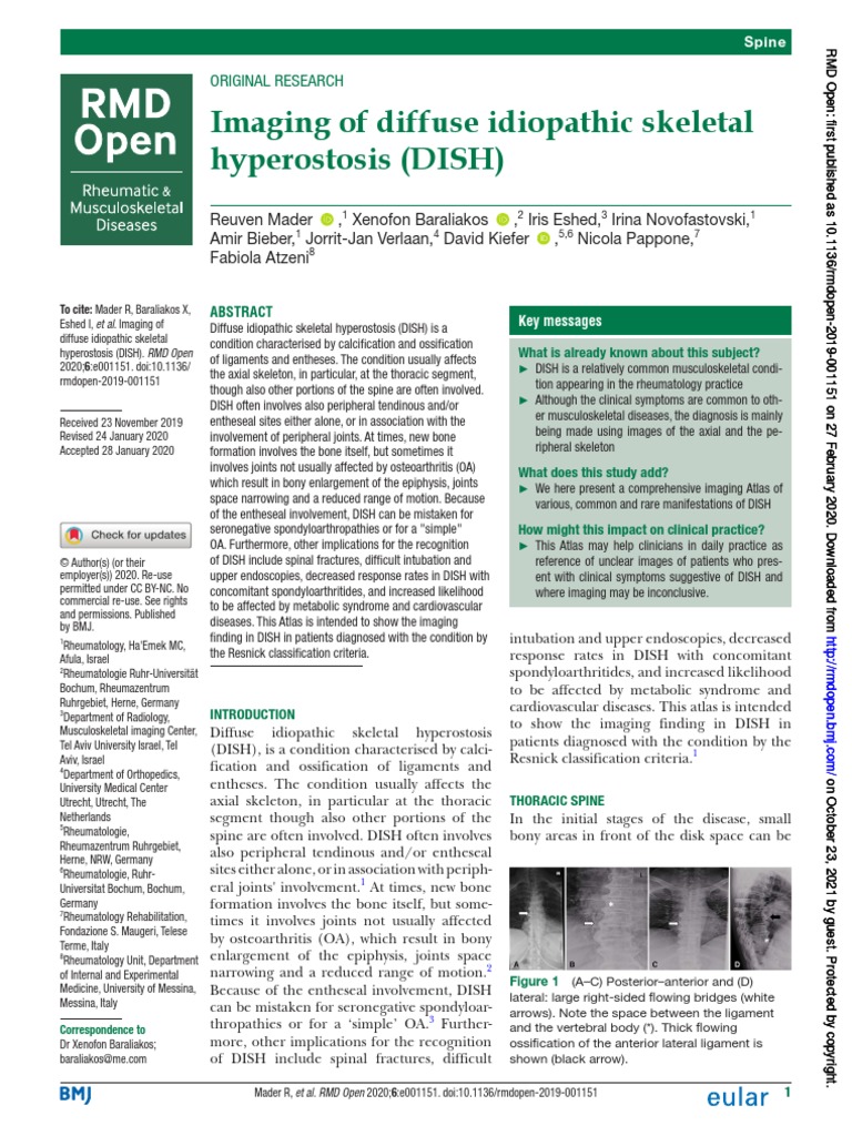 Imaging of Diffuse Idiopathic Skeletal Hyperostosis (DISH) : Original ...