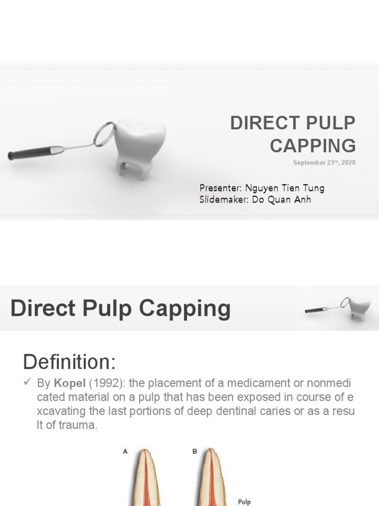 Direct Pulp Capping | PDF | Mouth | Dentistry Branches