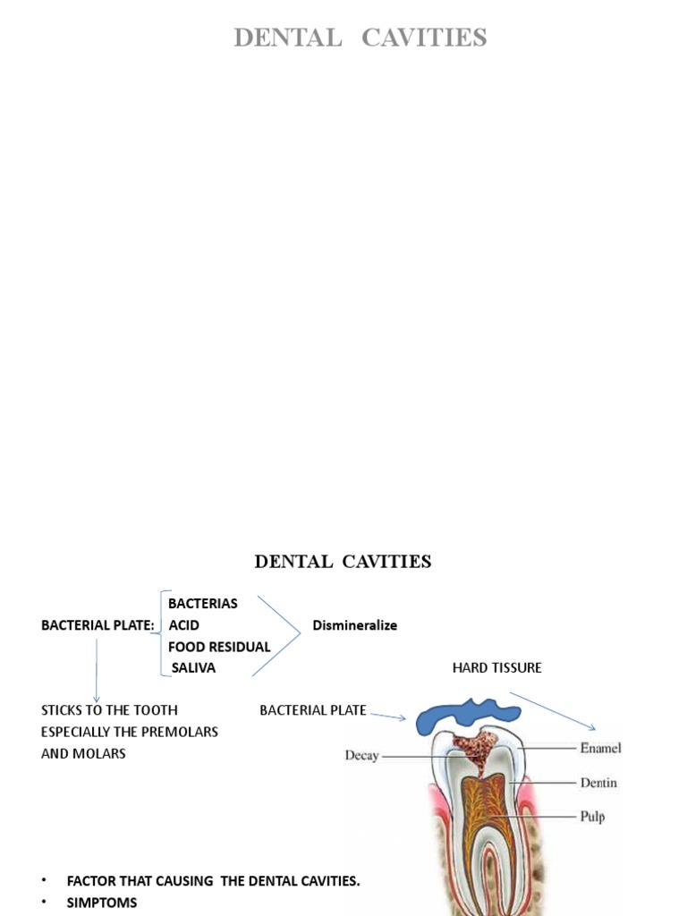 Cavities | PDF | Wellness