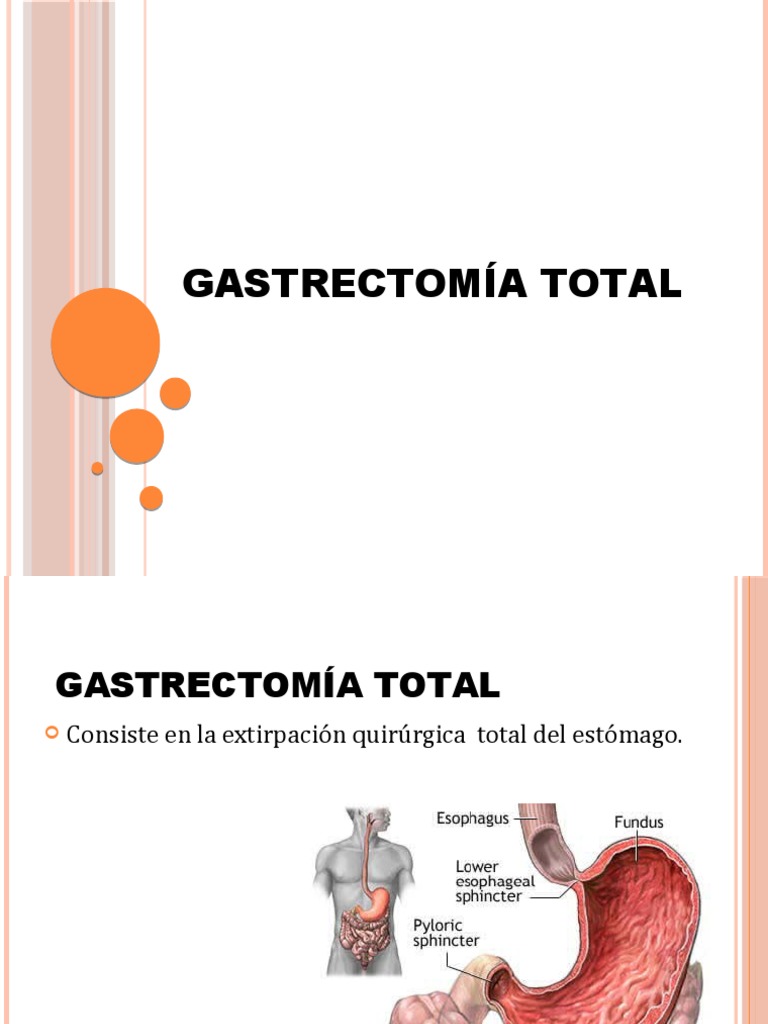 Gastrectomia Total..CORRECCION | Abdomen | Gastroenterología