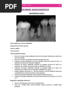 Canino Temporal Superior | PDF | Anatomia dental | Diente