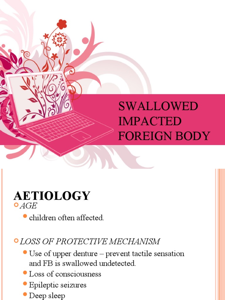 Swallowed Impacted Foreign Body-Gp1 | PDF | Esophagus | Gastroenterology