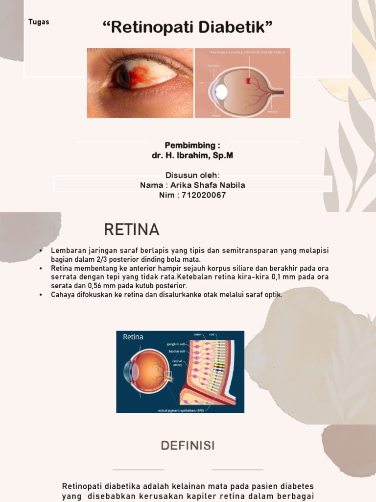 Retinopati Diabetes: Penyebab, Gejala, Diagnosis, dan ...
