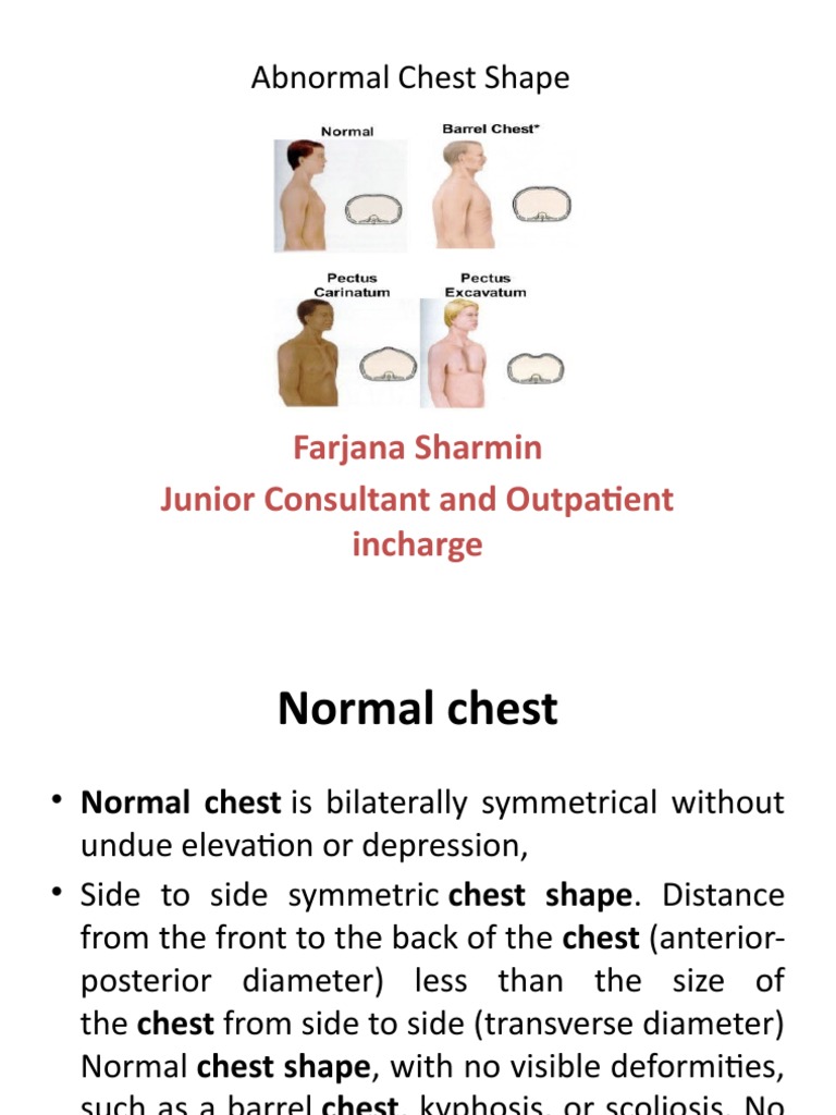 Abnormal Chest Shape: Farjana Sharmin Junior Consultant and Outpatient ...