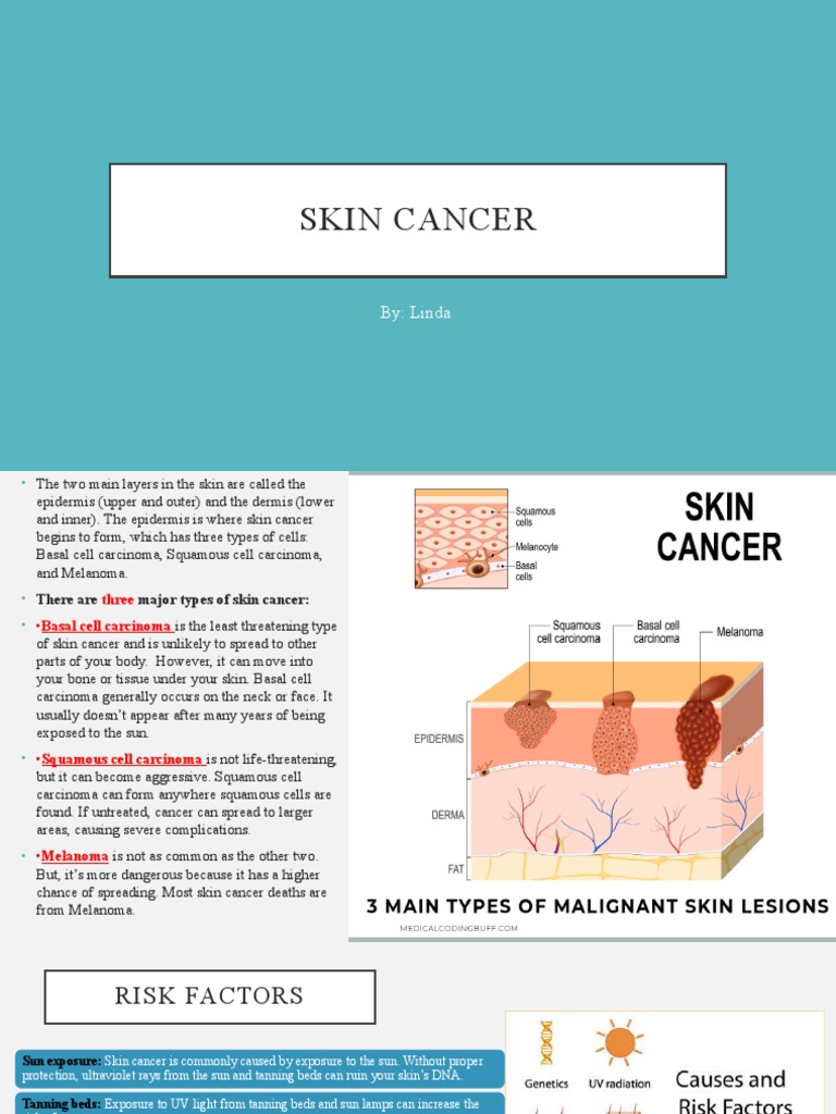 Presentation 3 | PDF | Skin Cancer | Melanoma