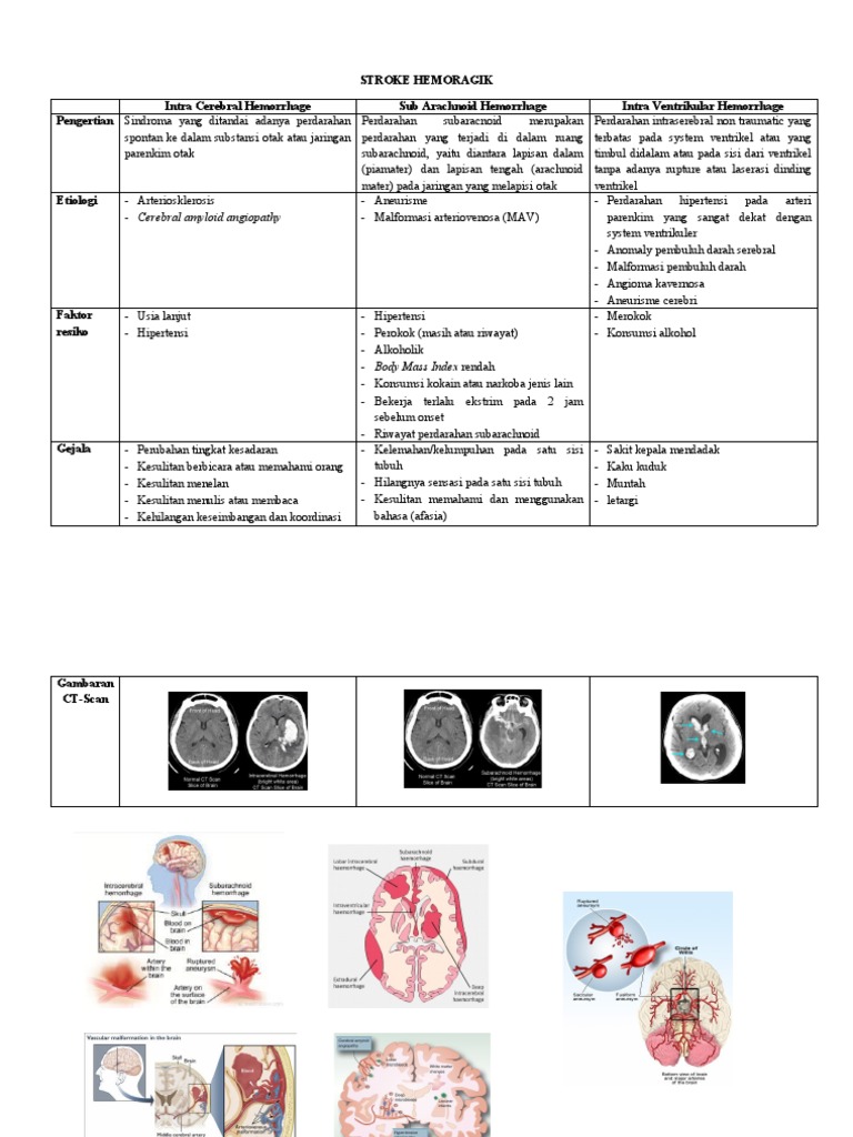 Panduan Stroke Hemoragik | PDF