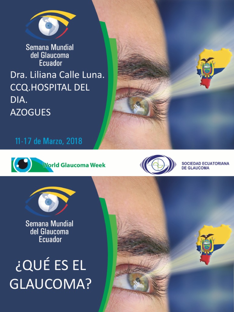 Charla Glaucoma | PDF | Glaucoma | Sistema visual