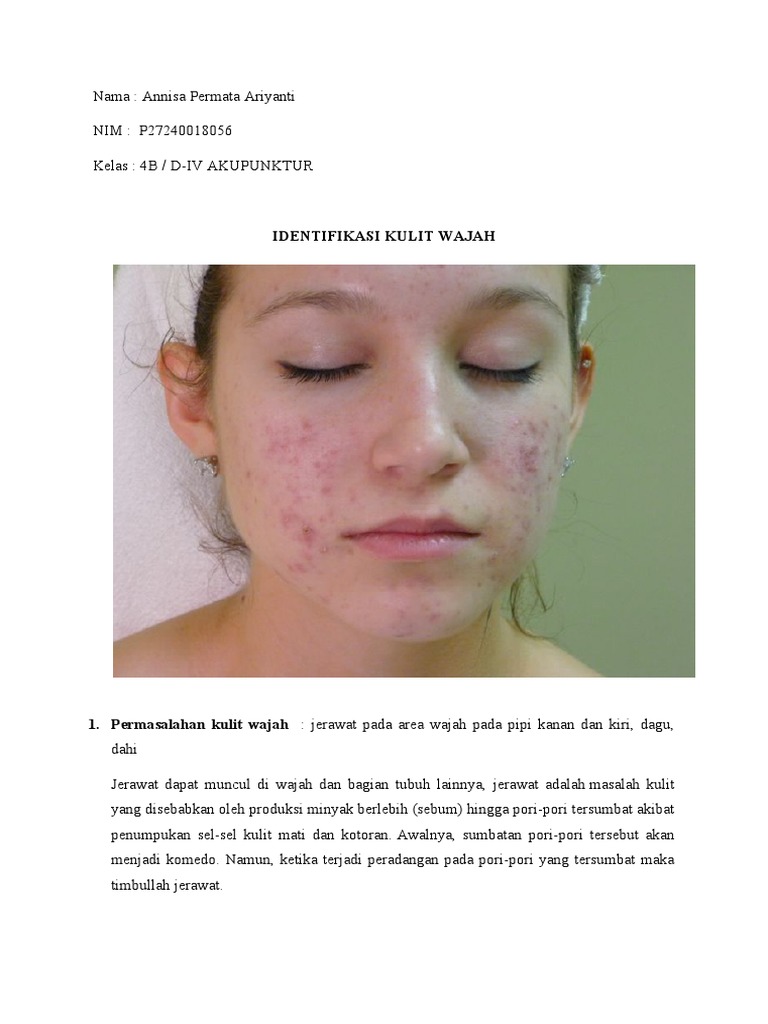 10 - Annisa Permata Ariyanti - Identifikasi Kulit | PDF