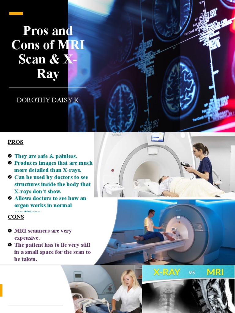 Pros and Cons of MRI Scan and X-Ray - Yr.8 | PDF