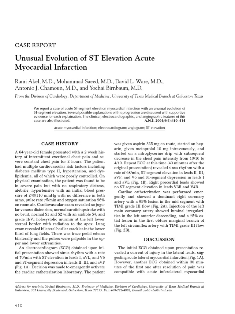 Myocardial Infarction | PDF | Electrocardiography | Myocardial Infarction