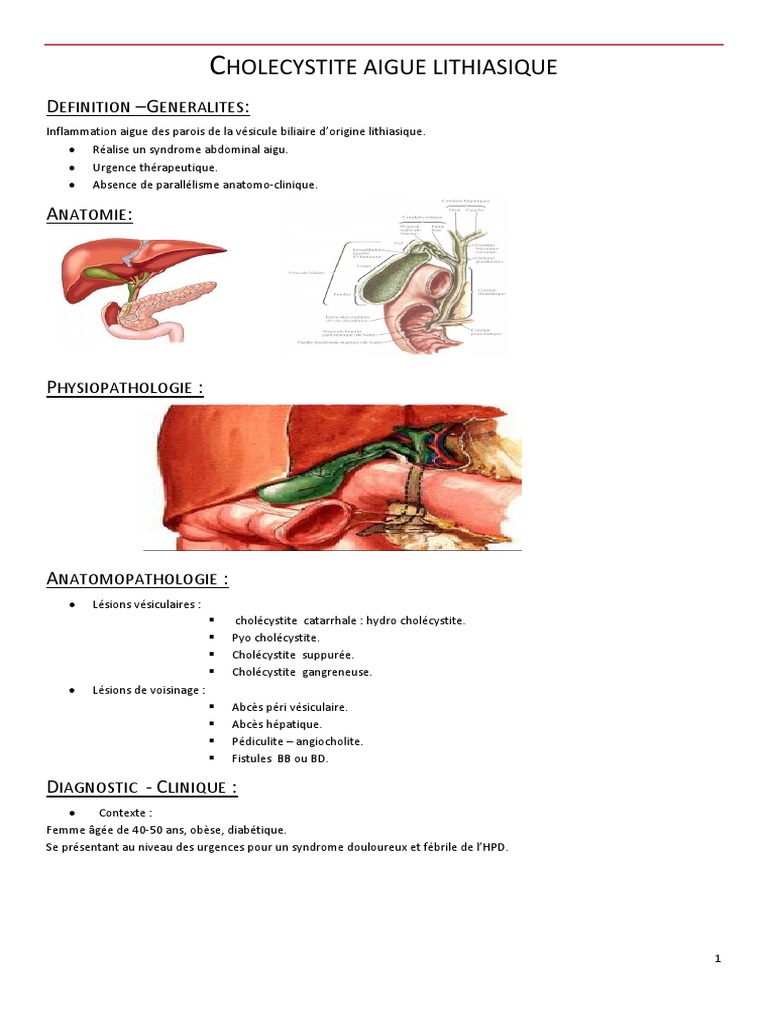 Gastro31-Cholecystite Aigue Lithiasique | PDF | Vésicule biliaire | Immunologie