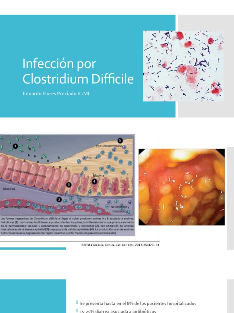Infección Por Clostridium Difficile | PDF | Especialidades Medicas ...