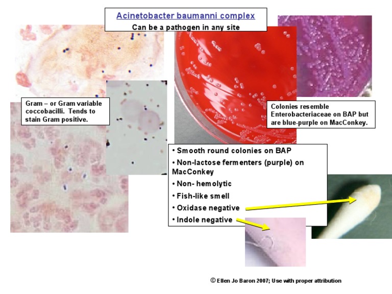 Acinetobacter Baumanni Complex: Can Be A Pathogen in Any Site | PDF