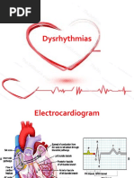 Understanding Delta Waves in ECG | PDF | Medical Specialties | Causes ...