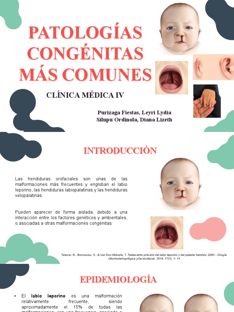 Patologías Congénitas Más Comunes | PDF | Anatomía humana ...