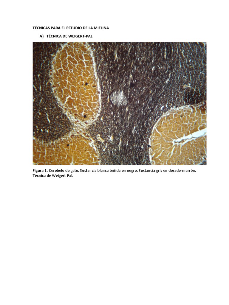 Imag Weigertpal Blue Black | PDF | Nervio | Cerebro