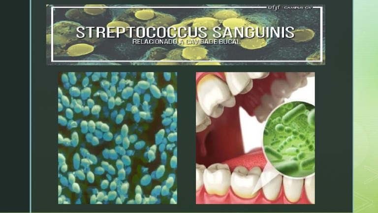 Streptococcus Sanguinis | PDF