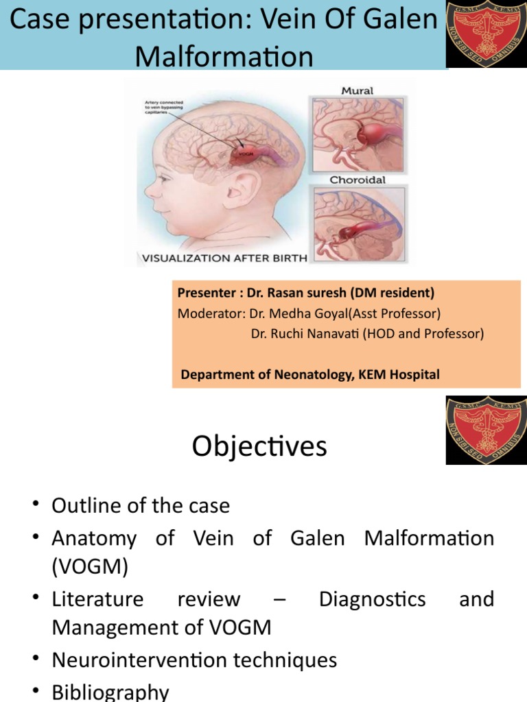 Vein of Galen Malformation | PDF | Medical Imaging | Coronary Circulation