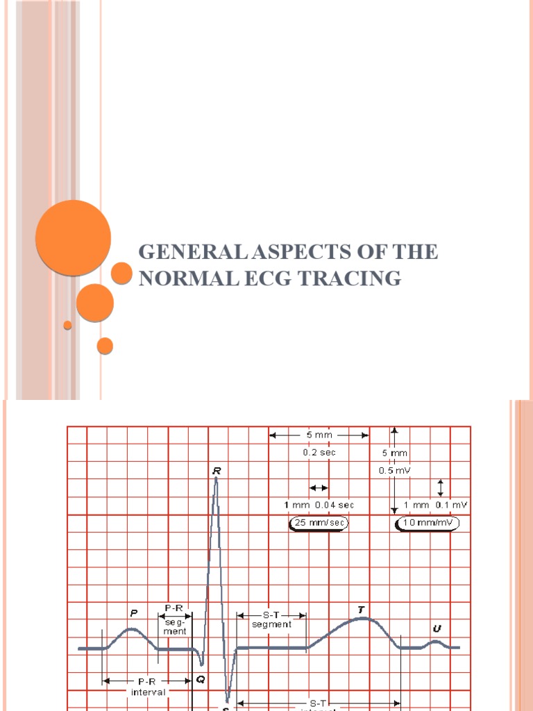 02 - ECG - General Approach and Normal Aspects 2 | PDF ...