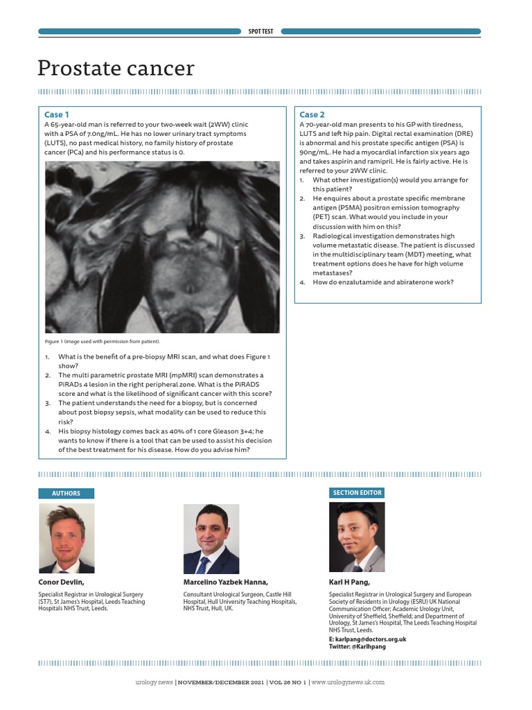 Prostate Cancer: Case 1 Case 2 | PDF | Prostate Cancer | Prostate ...