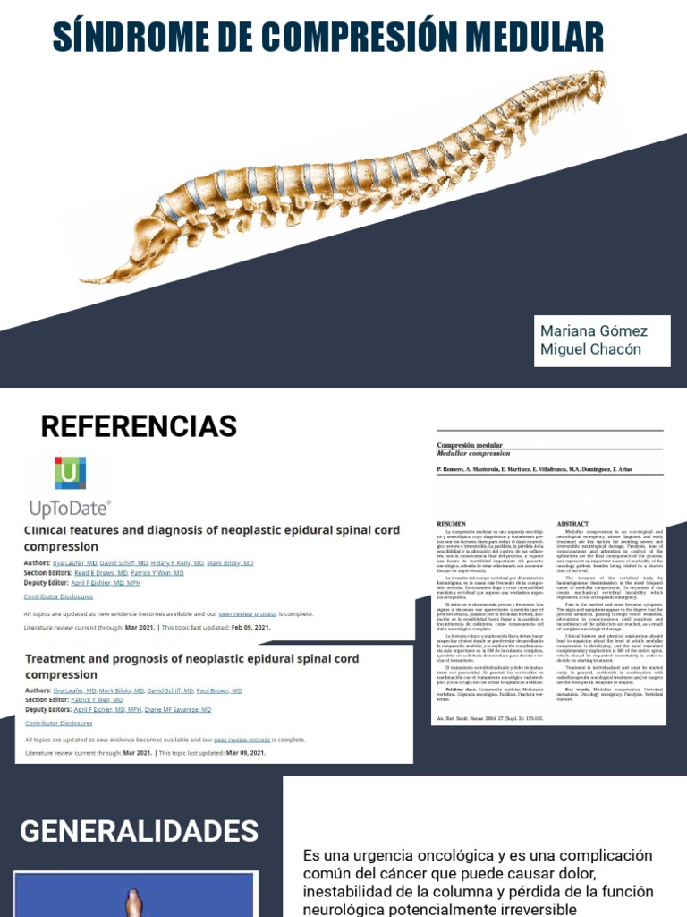Síndrome de Compresión Medular | PDF | Cáncer | Terapia de radiación