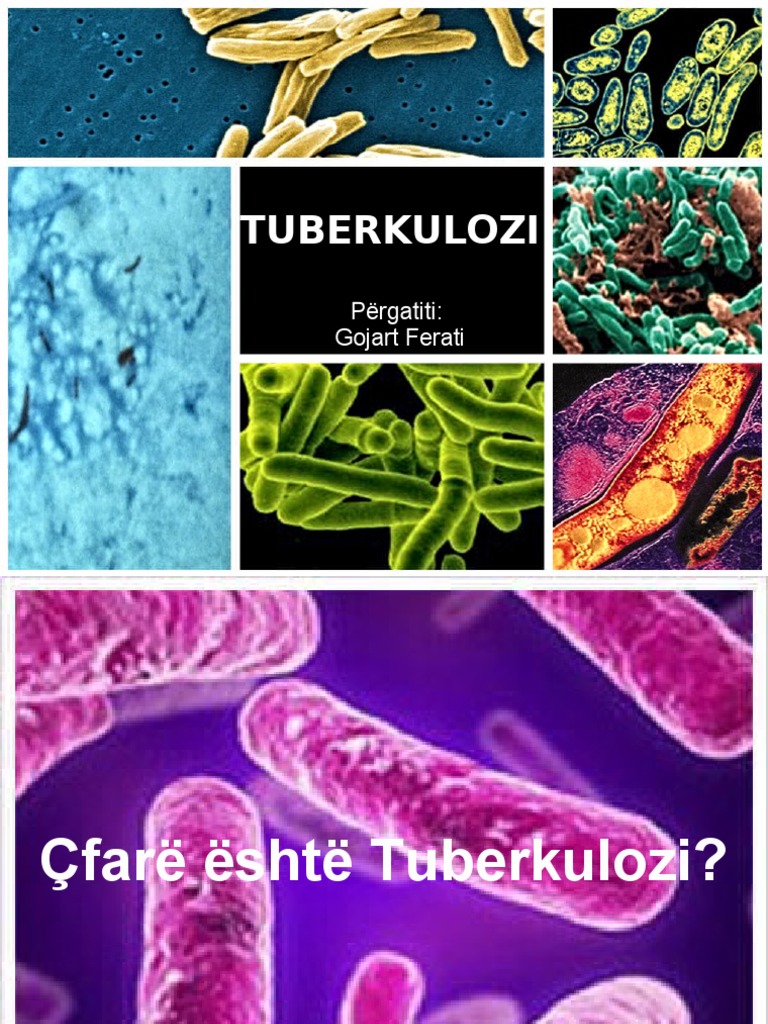 TUBERKULOZI | PDF