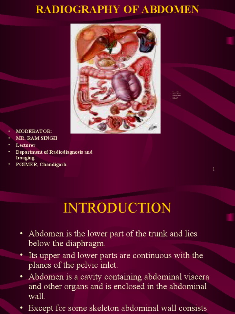 Moderator: Mr. Ram Singh Lecturer Department of Radiodiagnosis and ...