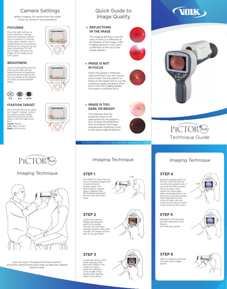 Pictor Plus - Technique Guide | Download Free PDF | Eye | Retina