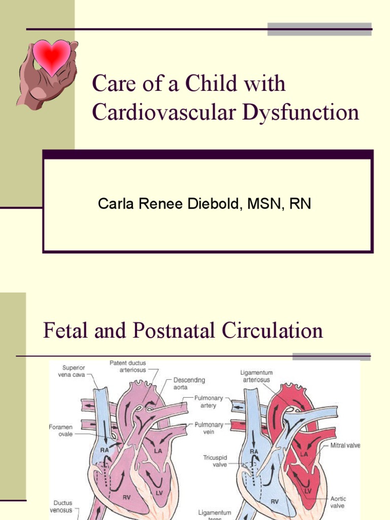 Child Cardiovascular Dysfunction Care | PDF | Congenital Heart Defect ...
