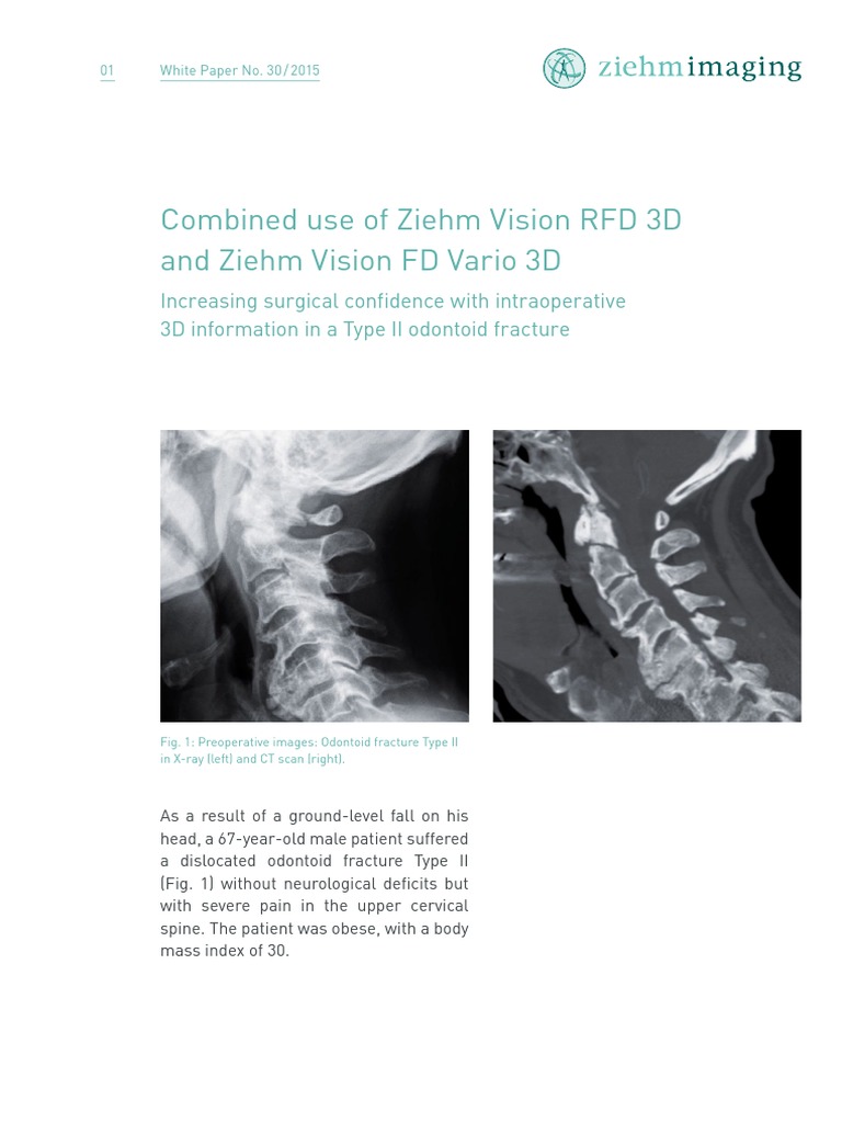 Combined Use of Ziehm Vision RFD 3D and Ziehm Vision FD Vario 3D | PDF | Ct Scan | Surgery