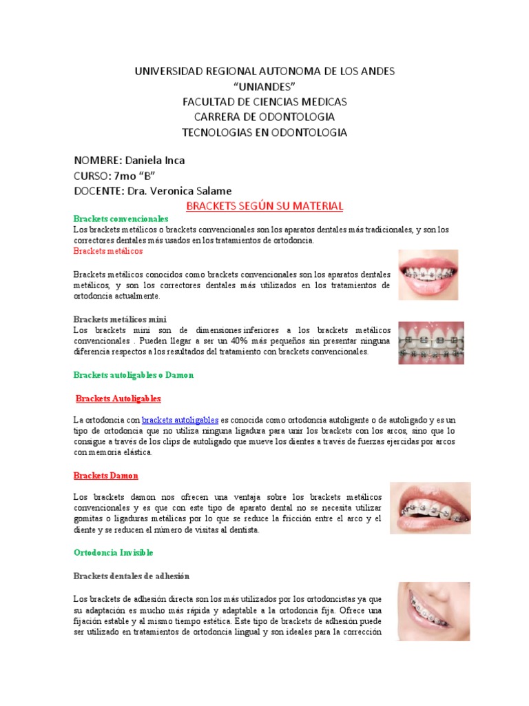 Tipos de Brackets. | PDF | Ortodoncia | Odontología