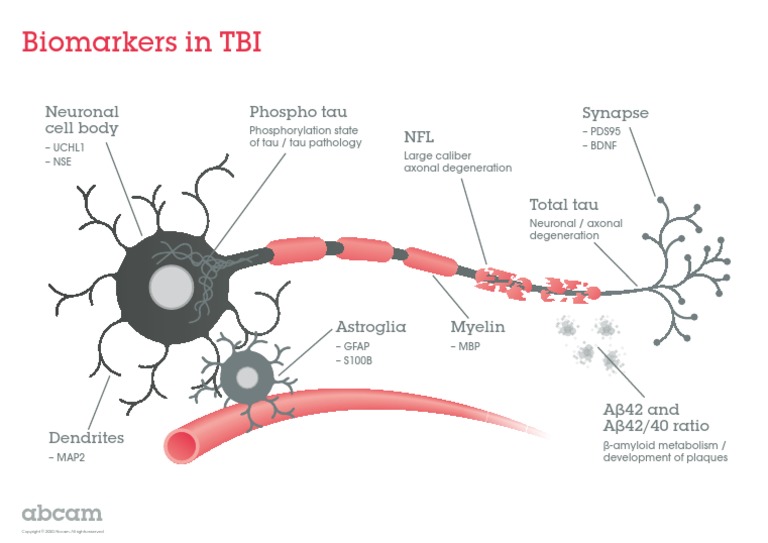Biomarkers in TBI: Synapse NFL Phospho Tau Neuronal Cell Body | PDF