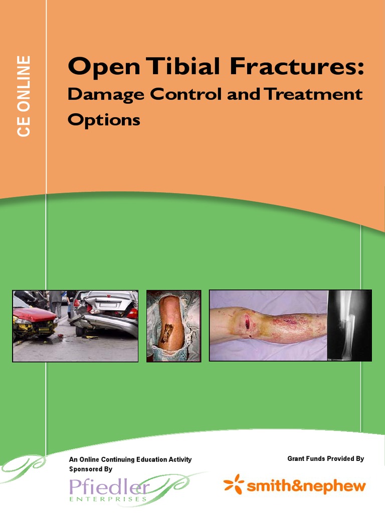 Open Tibial Fractures | PDF | Ankle | Musculoskeletal System