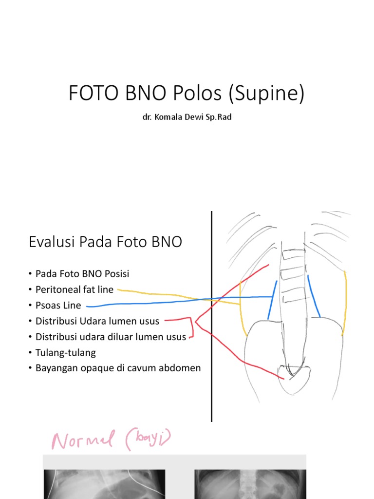 FOTO BNO Polos (Supine) | PDF