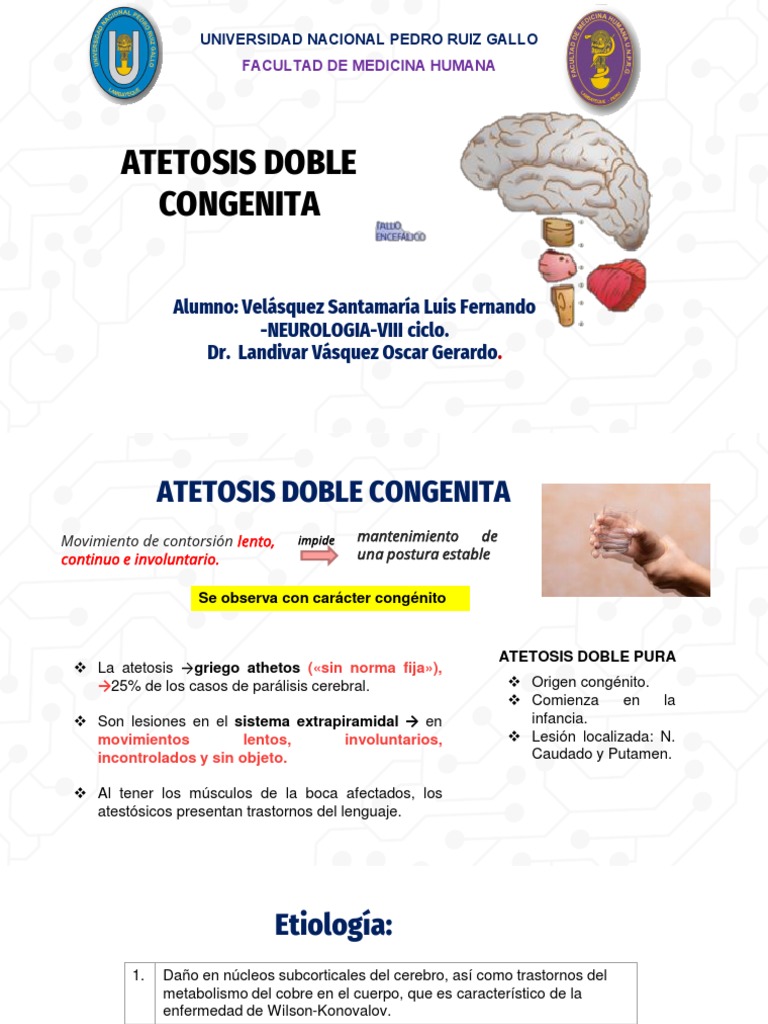 Semana 1o - Atetosis Doble Congenita - Velasquez Santamaria Luis ...
