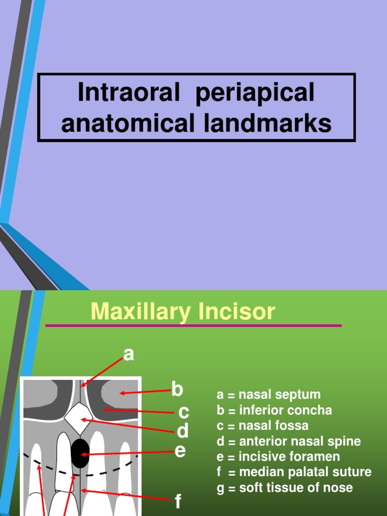 Intraoral Periapical Anatomical Landmarks | PDF | Human Nose | Dental ...
