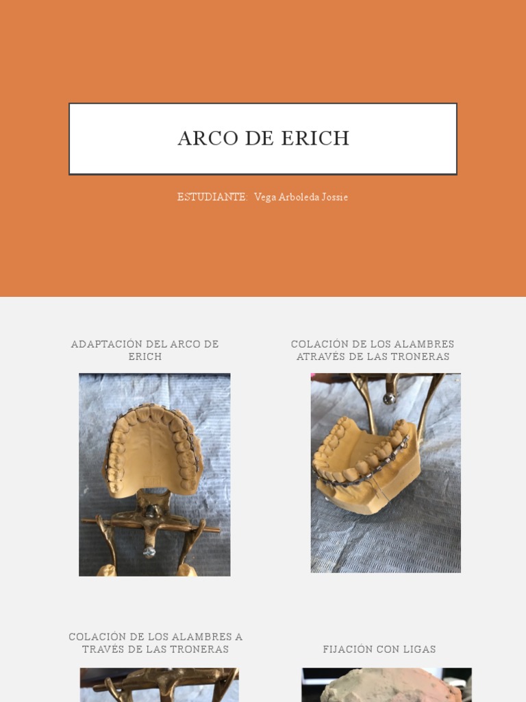 Adaptación del Arco de Erich | PDF