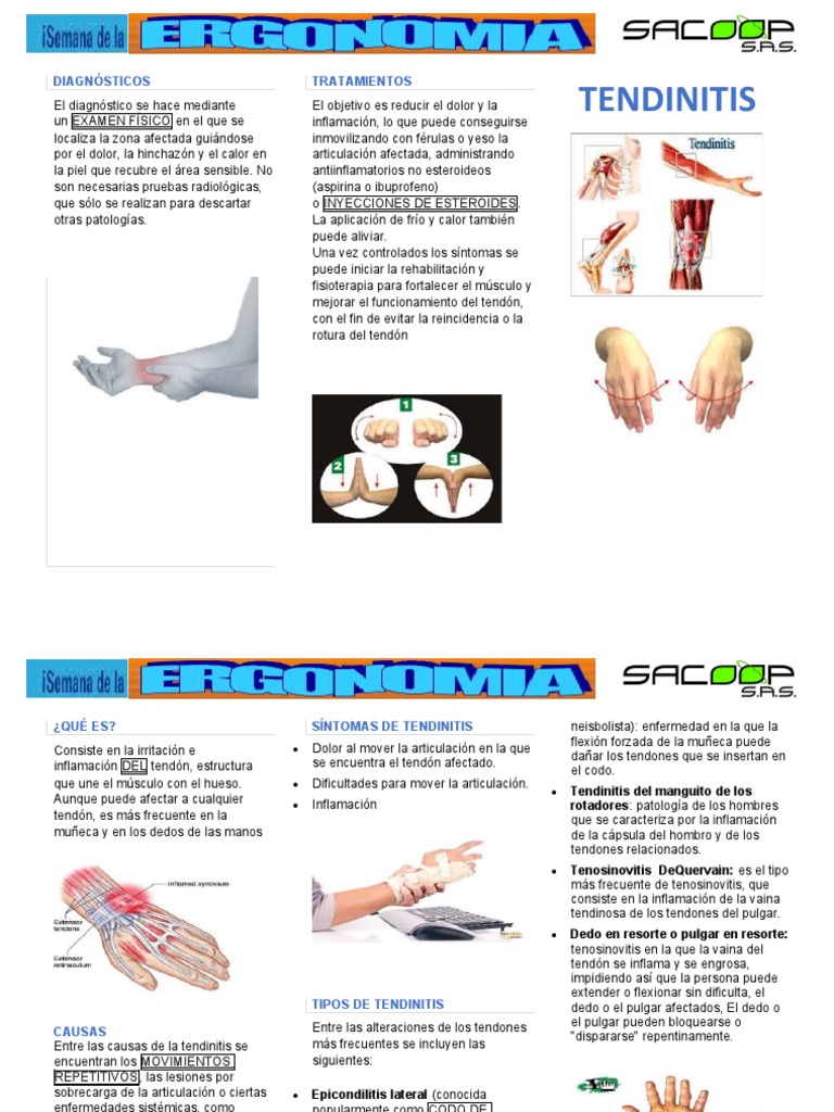 Diagnóstico y Tratamiento de Tendinitis | PDF | Ciencia de la danza ...