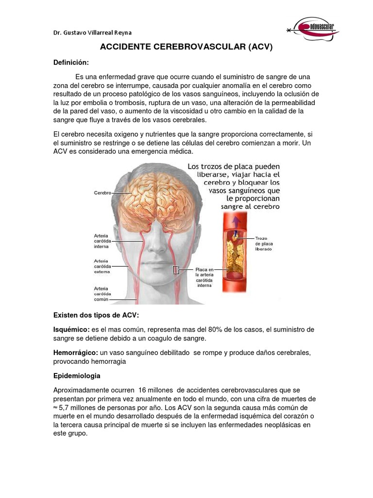 Tipos y Epidemiología del ACV | PDF | Carrera | Isquemia