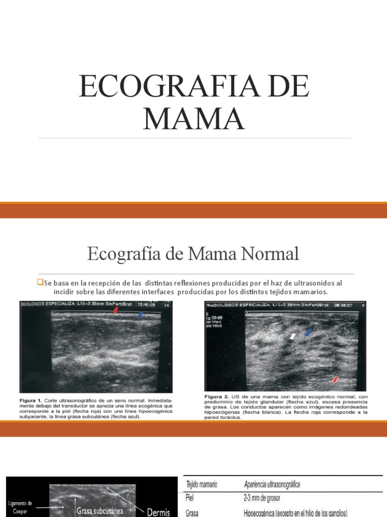 Ecografia de Mama | PDF