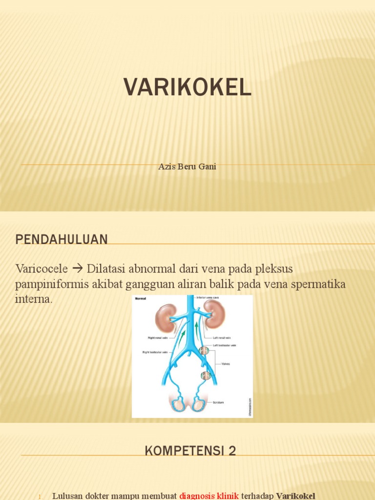 Varikokel, Hidrokel & Spermatokel | PDF