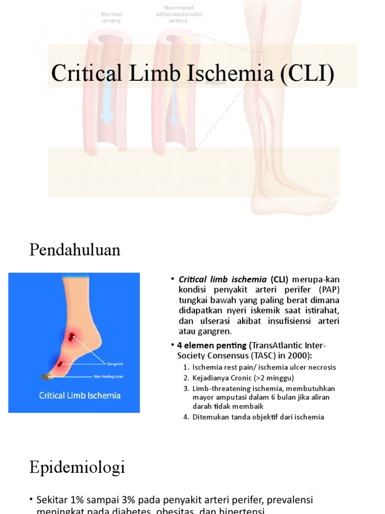 Pemahaman Critical Limb Ischemia (CLI) | PDF