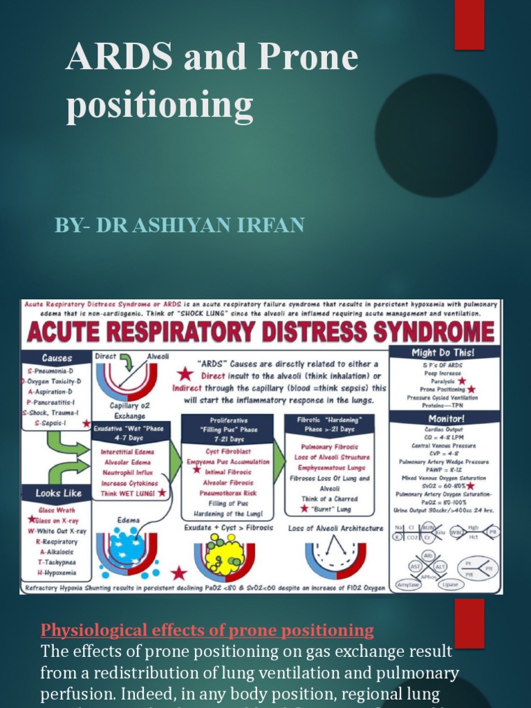 ARDS and Prone Positioning | PDF