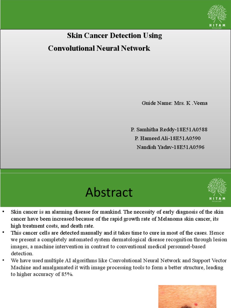 Skin Cancer Detection Using Convolutional Neural Network: Guide Name ...