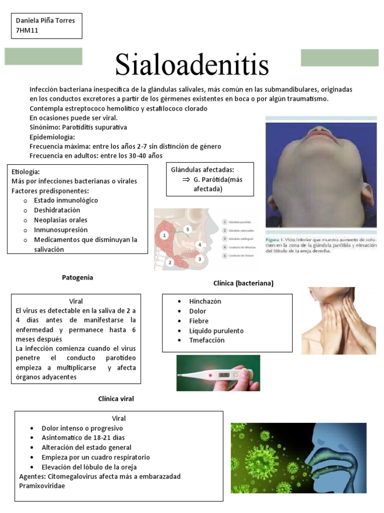 Sialoadenitis: Infección bacteriana de las glándulas salivales | PDF ...