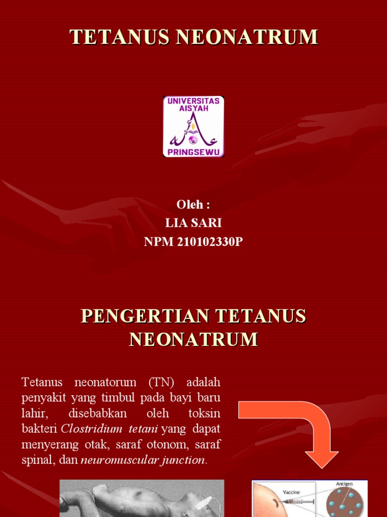 Tetanus Neonatrum | PDF